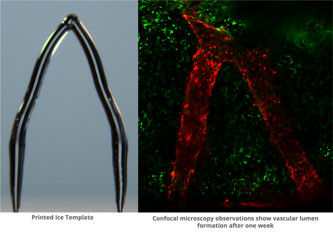 3D Ice Printing Blood Vessels - News | Biophysical Society